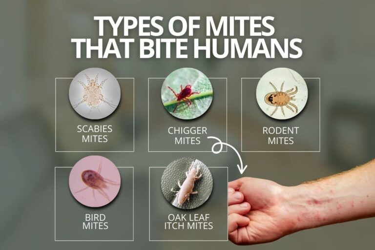What Do Mite Bites Look Like? Types, Symptoms, and Treatment