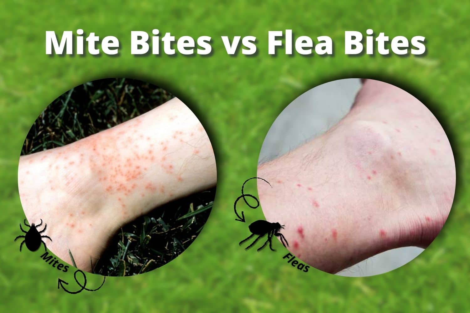What Do Mite Bites Look Like? Types, Symptoms, and Treatment
